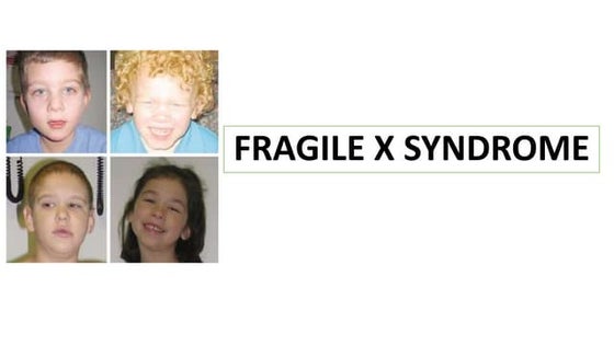 Fragile x syndrome | PPTX | Brain and Nervous System Disorders ...