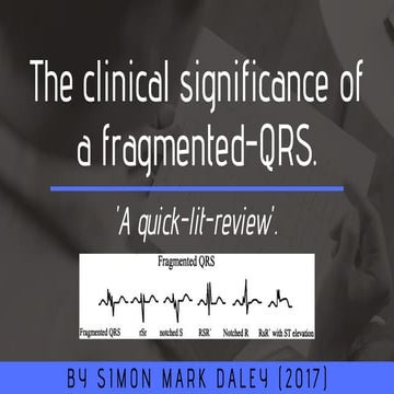 Fragmented QRS | PDF