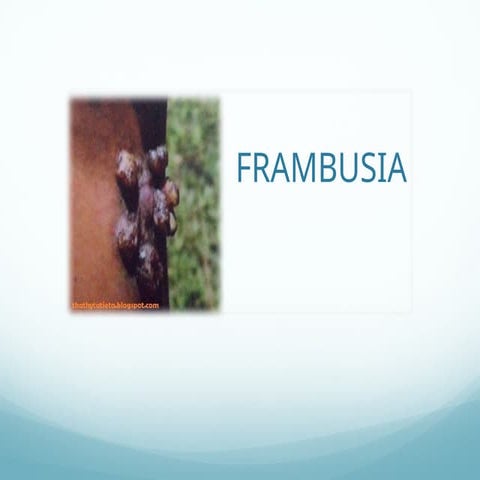 frambusiaaaaaaaaaaaaaaaaaaaaaaaaaaa.pptx