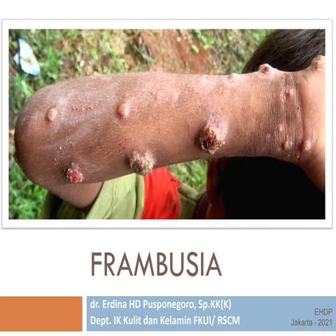 FRAMBUSIA dr. Erdina - Jakarta 2021 revisi 11 Okt.pdf