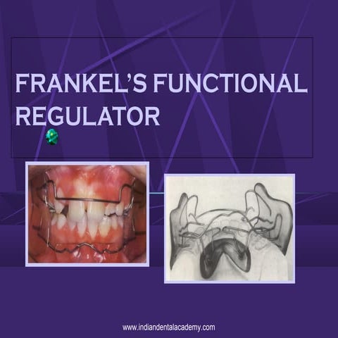 Frankel’s functional regulator | PPT