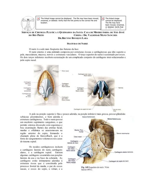 FRATURAS DA MAXILA.doc