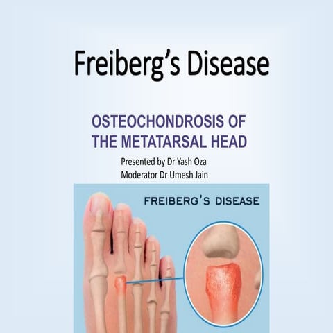 Acute pyogenic arthritis by dr ashutosh | PPTX