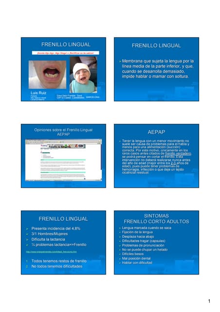 Frenillo lingual | PPT