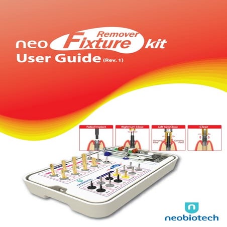 User guide universal prosthetic kit -151207 | PDF