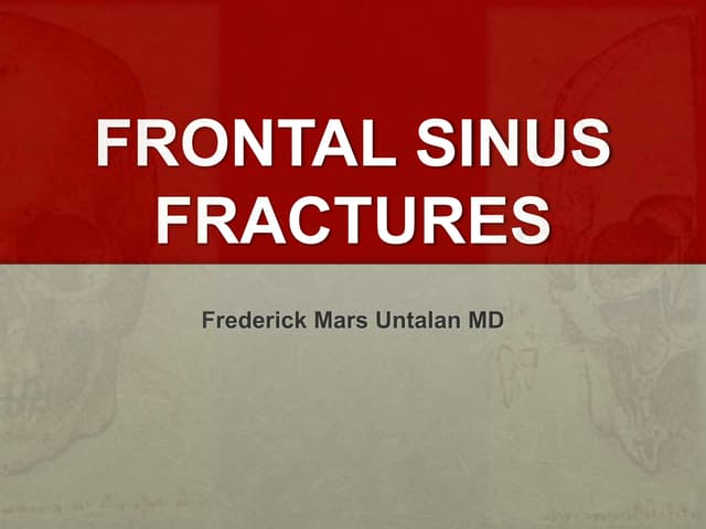Radiological anatomy of frontal sinus | PPT