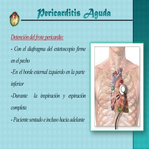 frote pericardico.pptx