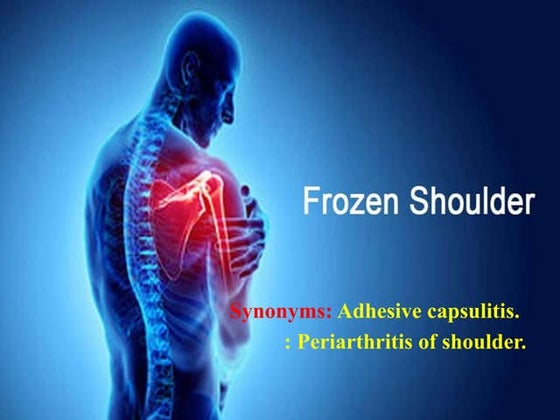 Frozen shoulder | PPTX | Physical Therapy | Wellness