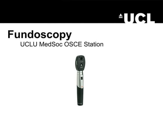 Basic fundoscopy | PPTX | Eye and Vision Conditions | Diseases and ...