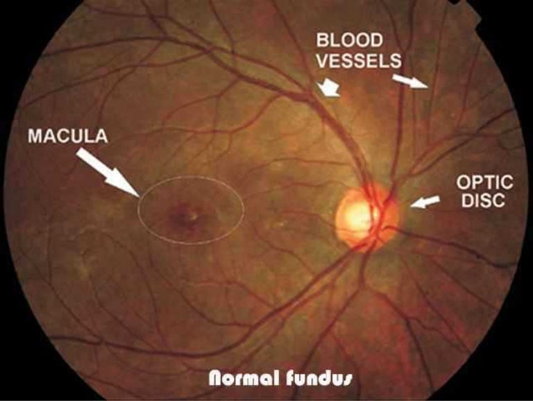 Fundus examination
