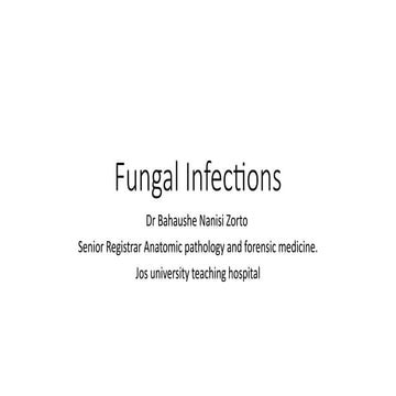 Comprehensive Overview of Nephrolithiasis: Types, Causes, Diagnosis ...