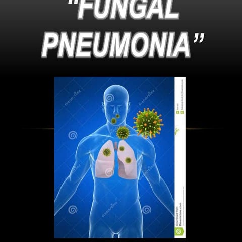 Fungal pneumonia | PPTX
