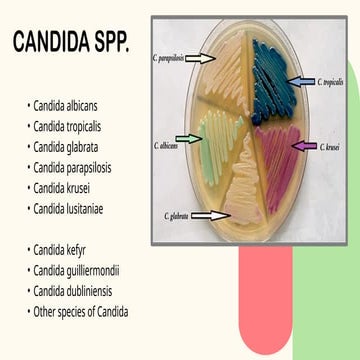 Candidiasis – clinical manifestations and lab diagnosis of oral ...