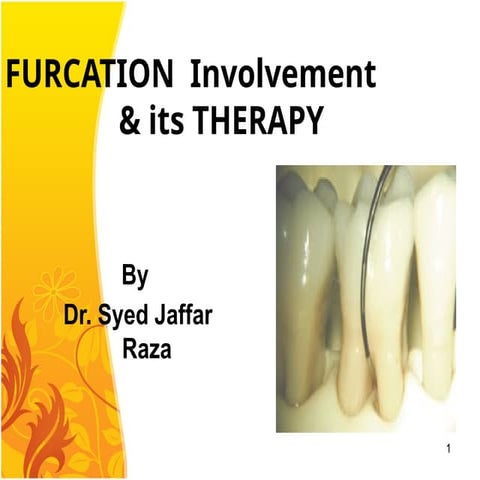 Furcation Involvement and its Therapy.pptx