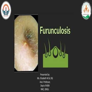 Otitis Externa Furuncle The Prevalence Of Various Eyelid Skin Lesions