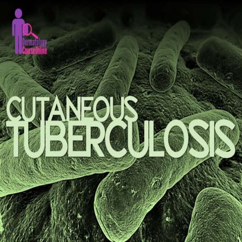 Cutaneous Tuberculosis | PPTX