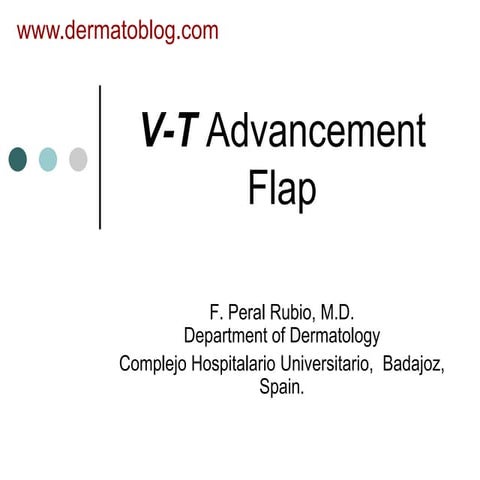V-T advancement flap. | PPT