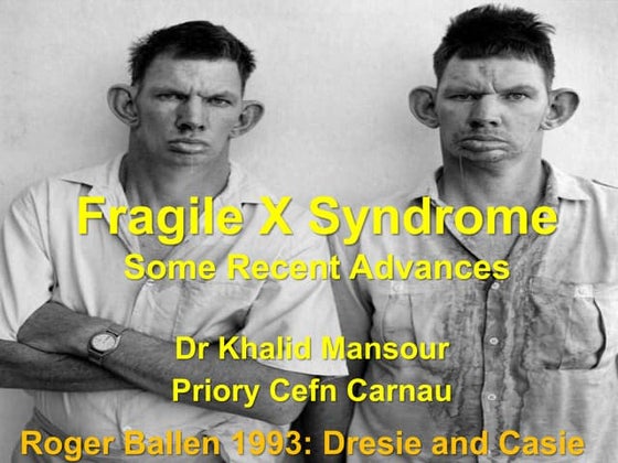Fragile x syndrome | PPTX | Brain and Nervous System Disorders ...