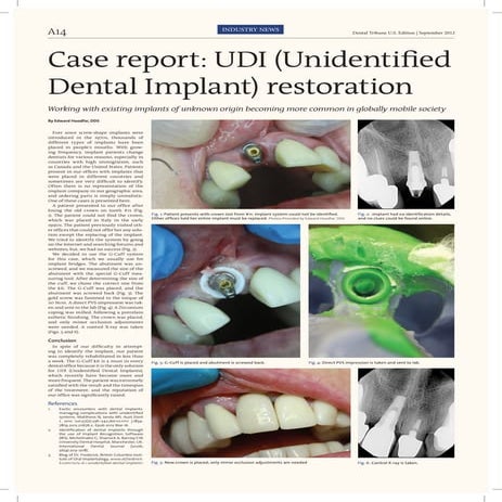 G-Cuff™ implant impression and unknown implants - October 2012 | PDF