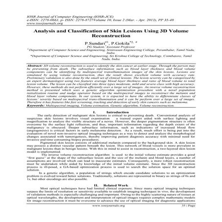 Segmentation Of Skin Lesion From Digital Images Using Texture Distinc 