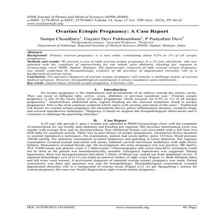 Ovarian Ectopic Pregnancy: A Case Report | PDF