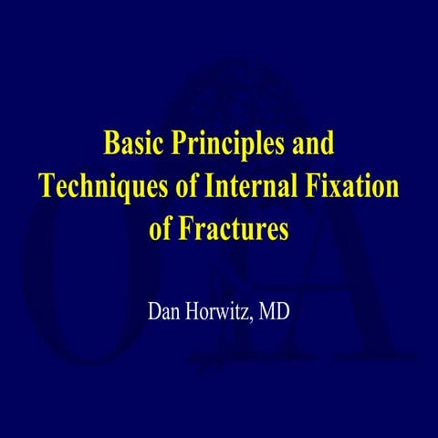 G10 internal fix principles | PPT