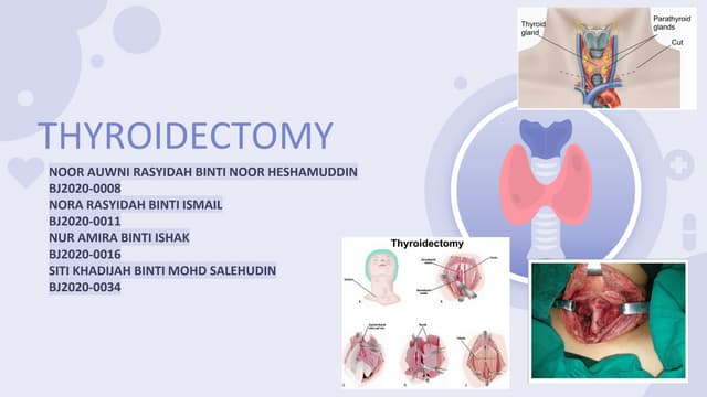 Thyroidectomy nursing care | PDF