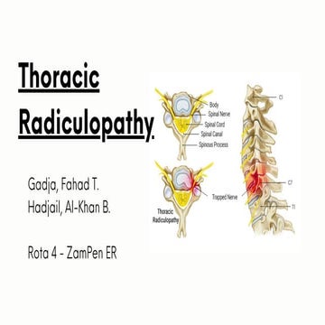 Gadja-and-Hadjail-thoracic-radiculopathy.pdf