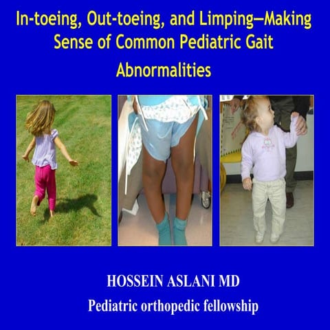 gait abnormalities in children.ppt