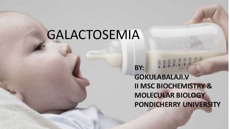 Galactosemia ppt
