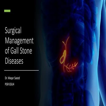 Gall stone management Copy.pptx