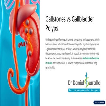 Do You Have Gallstones or Gallbladder Polyps? Here's How to Tell the ...