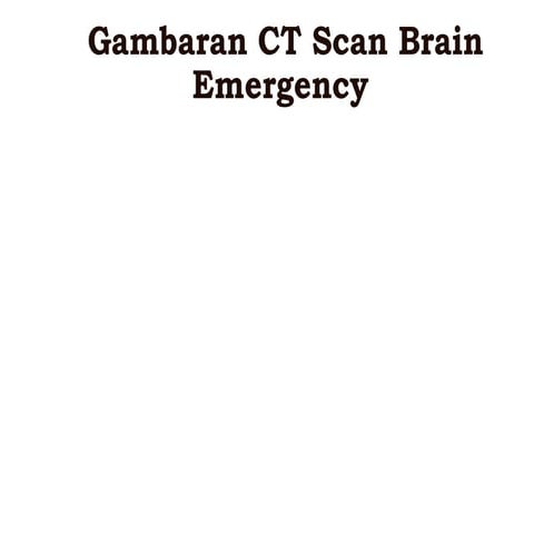 Gambaran CT Scan Radiologi CT Scan Radio | PPTX