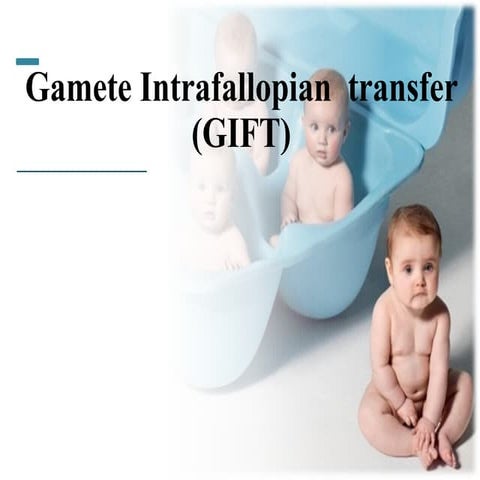 Gamete Intrafallopian transfer (GIFT).pdf