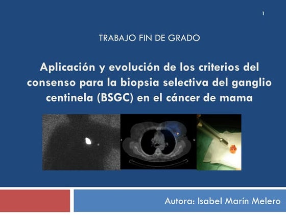 Biopsia de ganglio centinela (técnica combinada) en cáncer de mama | PPTX