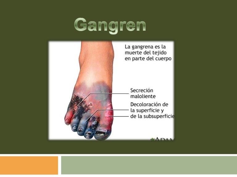 Gangrena de fournier