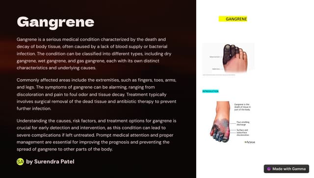 Gangrene #Types of gangrene | PPTX