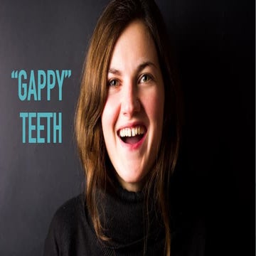 Gappy Teeth Should you Correct Them | PDF