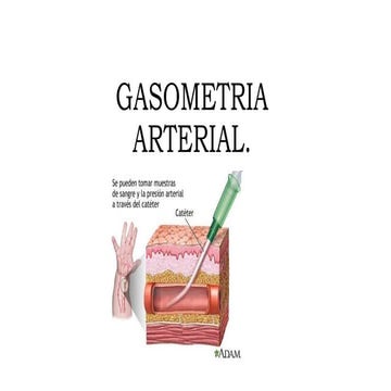 GASOMETRIA ARTERIAL TÉCNICA DE EXTRACCIÓN.pptx