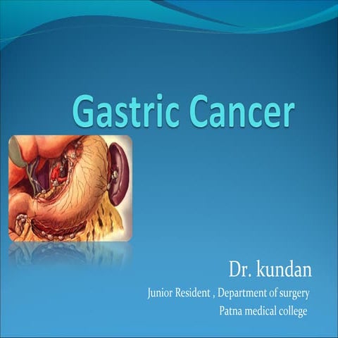 Gastric cancer | PPT