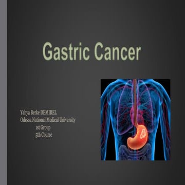 Gastric cancer | PPT