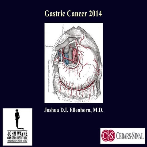 Gastric Cancer Surgery | PPT
