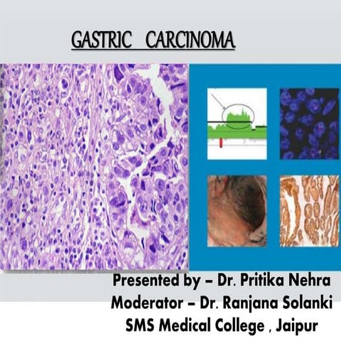 Gastric Cancer - Pathology Seminar | PPTX