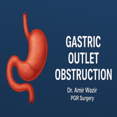 Presentation on Gastric outlet Obstruction | PPTX