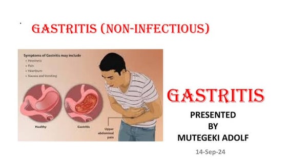 Peptic ulcer disease (pud) | PPT