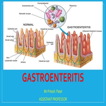Gastroenteritis.pptx