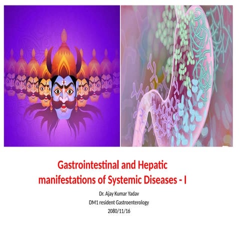 Gastrointestinal and Hepatic manifestations of Systemic Diseases-I.pptx