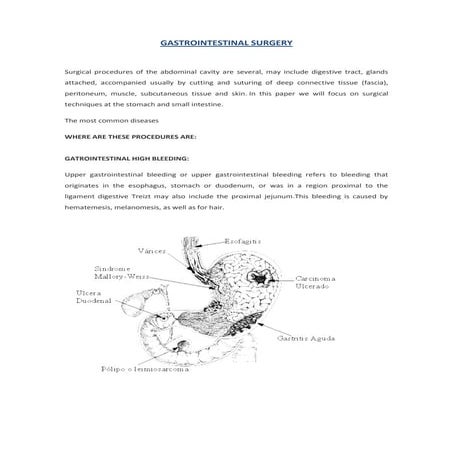 Gastrointestinal surgery | DOCX