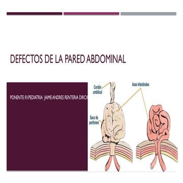 Defectos de pared abdominal | PDF