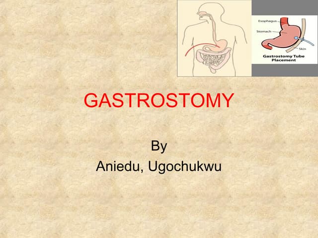 Seminar on stamm, janeway & PE gastrostomy | PPTX